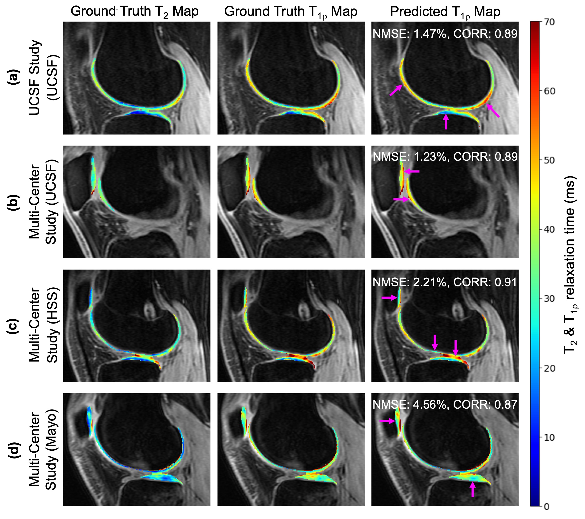 New Approach to Deep Learning Imaging Protocols